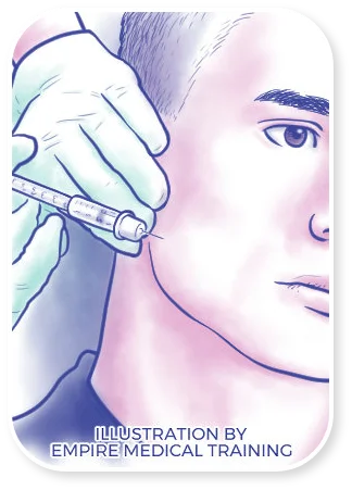 Botox® For Jaw Clenching - Empire Medical Training Blog