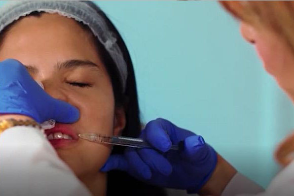 Advanced Lip Filler Techniques | Empire Medical Training