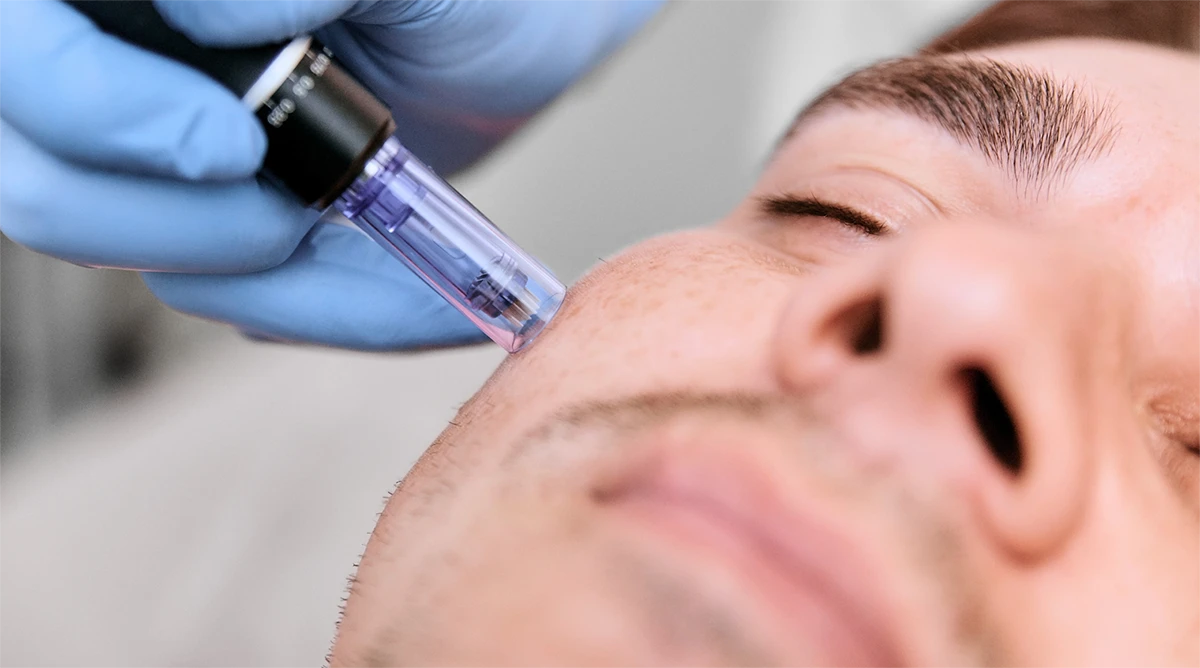 Complete Facial Aesthetics in Los Angeles, CA — Mar 19, 2027 | Empire ...